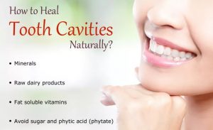 How to Heal Cavities Naturally - RRDCH